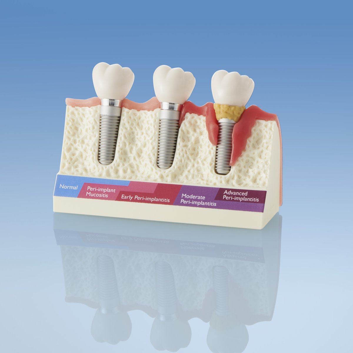 Tooth models - Dentalinstituttet