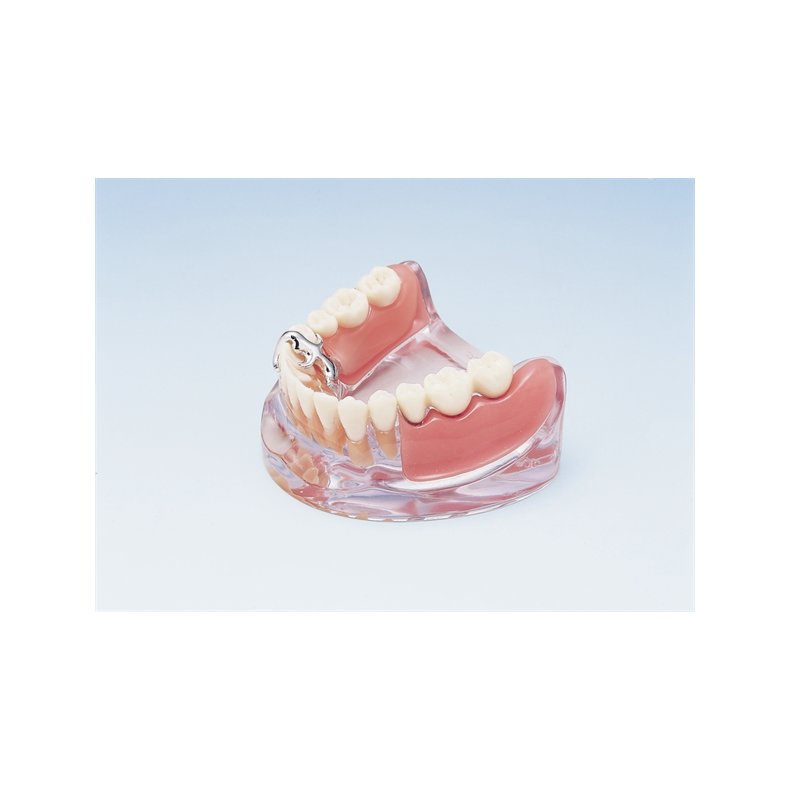 Implantat og delprotese - Patientundervisning - Dentalinstituttet