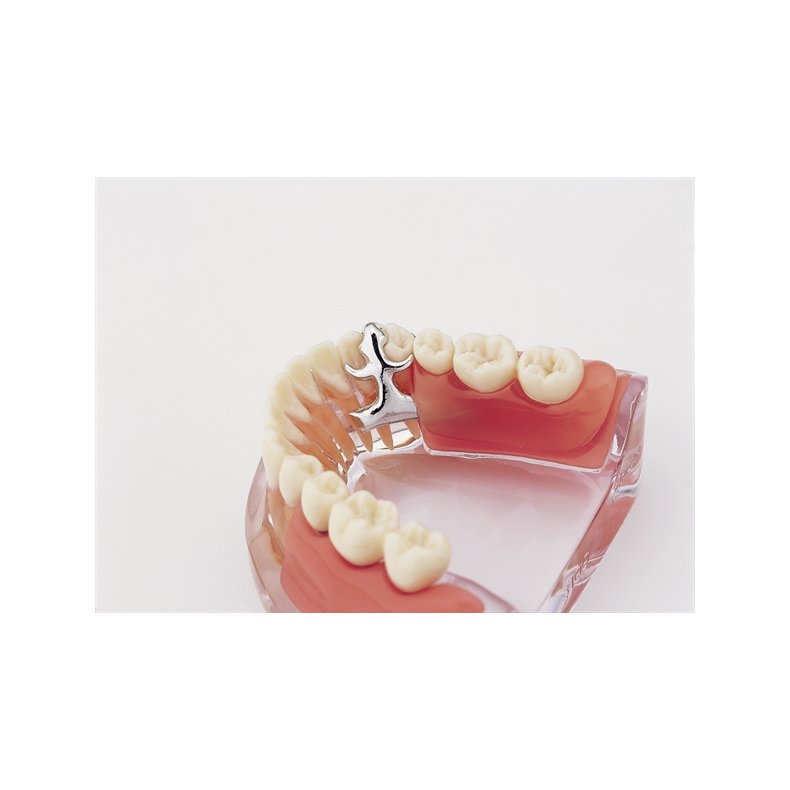 Implantat og delprotese - Patientundervisning - Dentalinstituttet