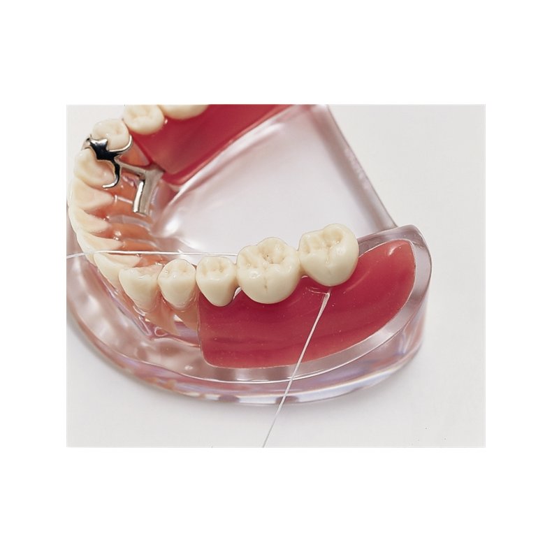 Implantat og delprotese - Patientundervisning - Dentalinstituttet