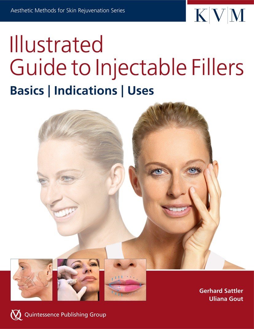 Illustrated Guide to Injectable Fillers - Bøger - Dentalinstituttet